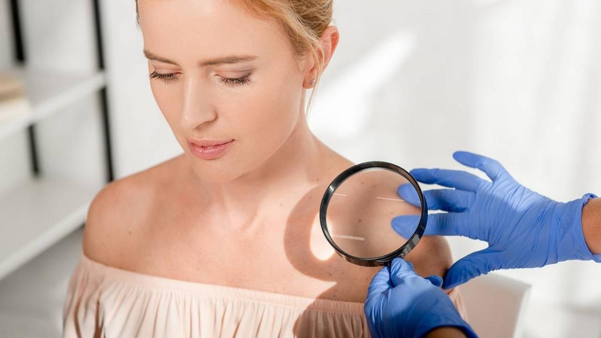 Día Mundial Del Melanoma Cómo Prevenirlo Los Cuidados A Tener Y A Qué