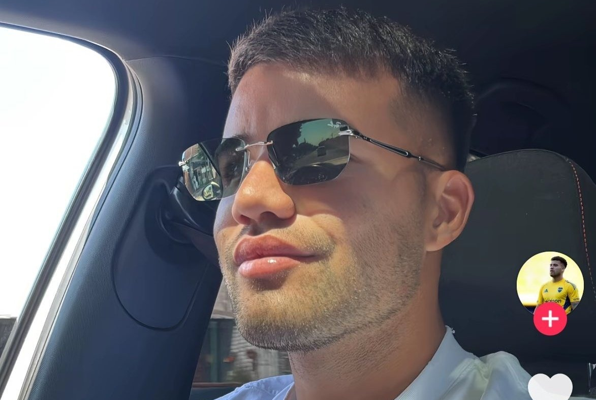 Labios nuevos y otra oportunidad: el "Chelo" Weigandt, entre el "bótox ...